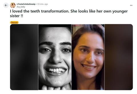 Kusha Kapila's face transformation: Netizens go from 'Teeth veneers ...